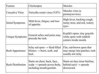 Measles vs chickenpox with definition , causes, symptoms, stages ...