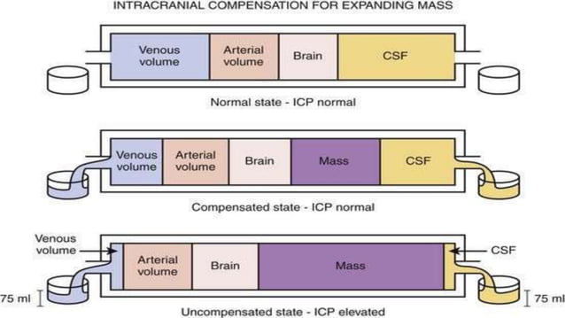 Measurement and management of increased intracranial pressure | PPT