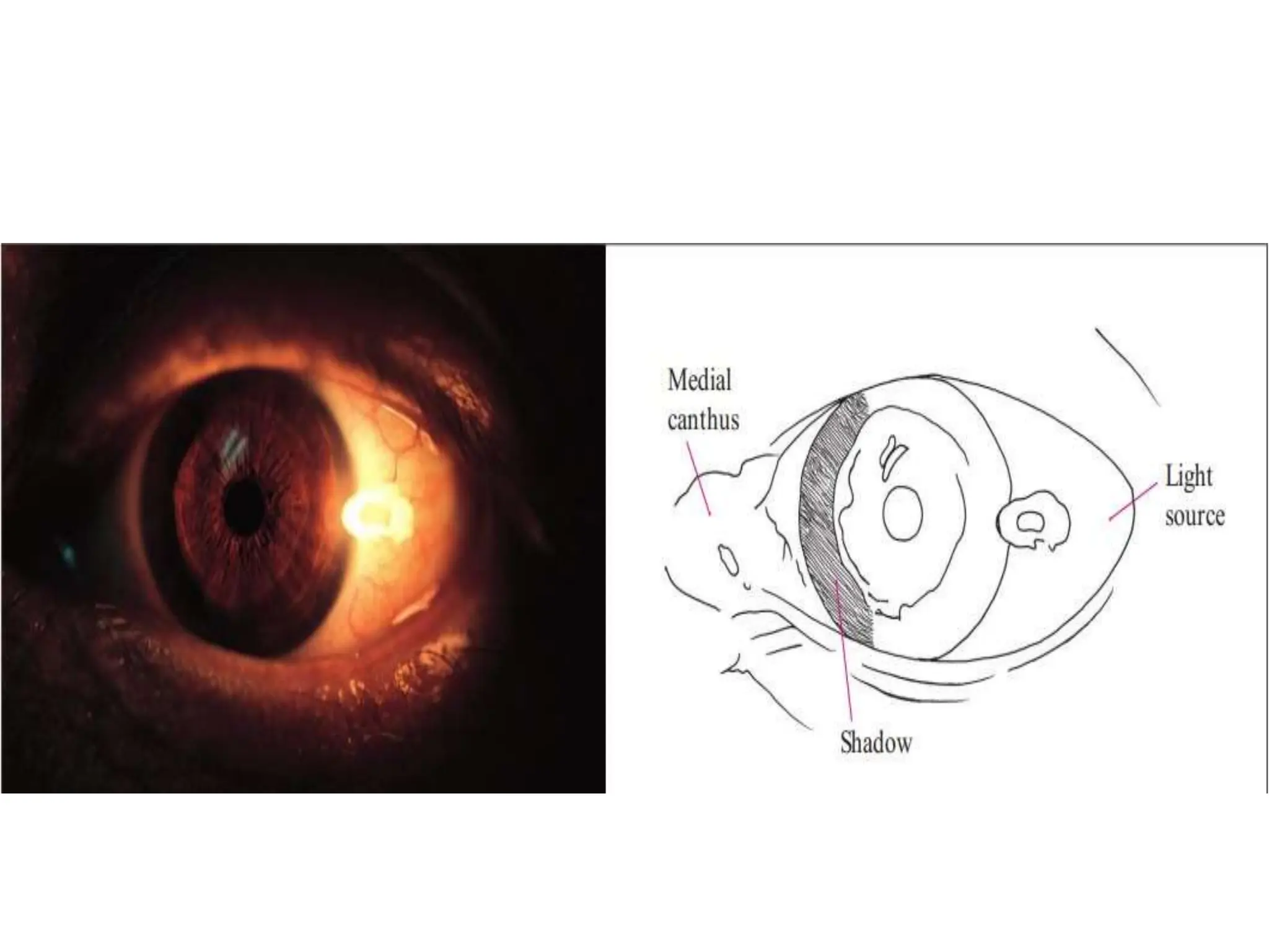 Measurement of angle of the AC.pptx