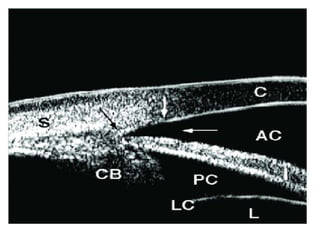 Measurement of angle of the AC.pptx