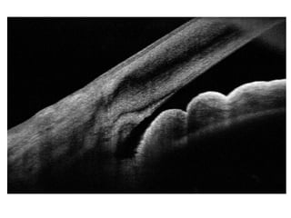 Measurement of angle of the AC.pptx