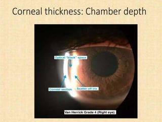 Measurement of angle of the AC.pptx