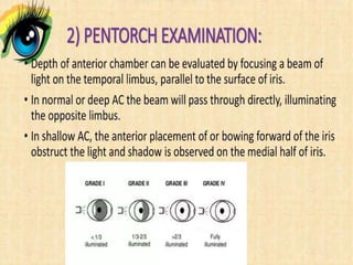 Measurement of angle of the AC.pptx
