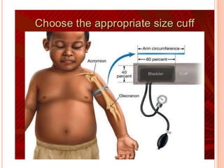 Measurement of blood pressure in children | PPTX