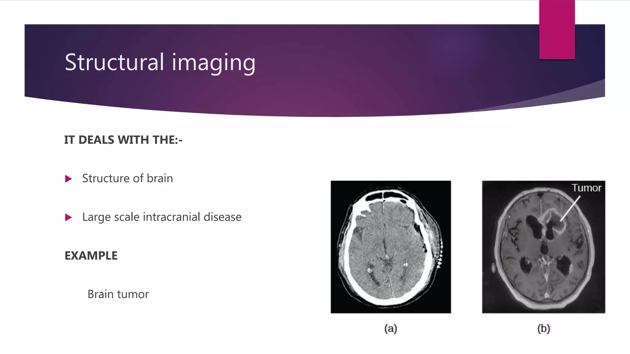 Measurement of brain | PPTX
