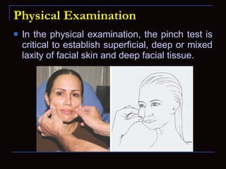 Measurement Of Facial Skin And Soft Tissue Laxity | PPT