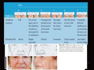 Measurement Of Facial Skin And Soft Tissue Laxity | PPT