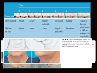 Measurement Of Facial Skin And Soft Tissue Laxity | PPT