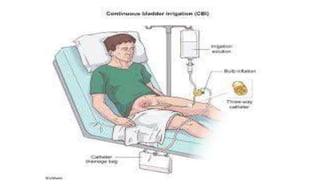 Measurement of fluid_intake_&_output | PPT