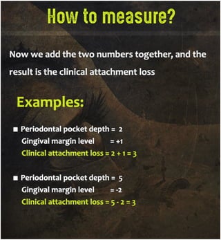 Measurement of Periodontal Attachment Loss | PDF