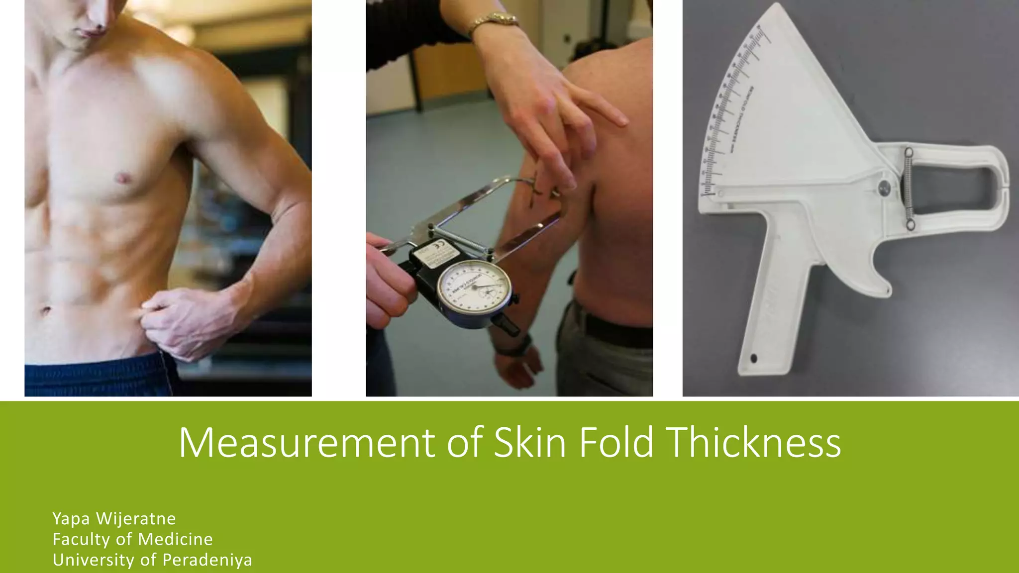 Measurement of skin fold thickness | PPTX
