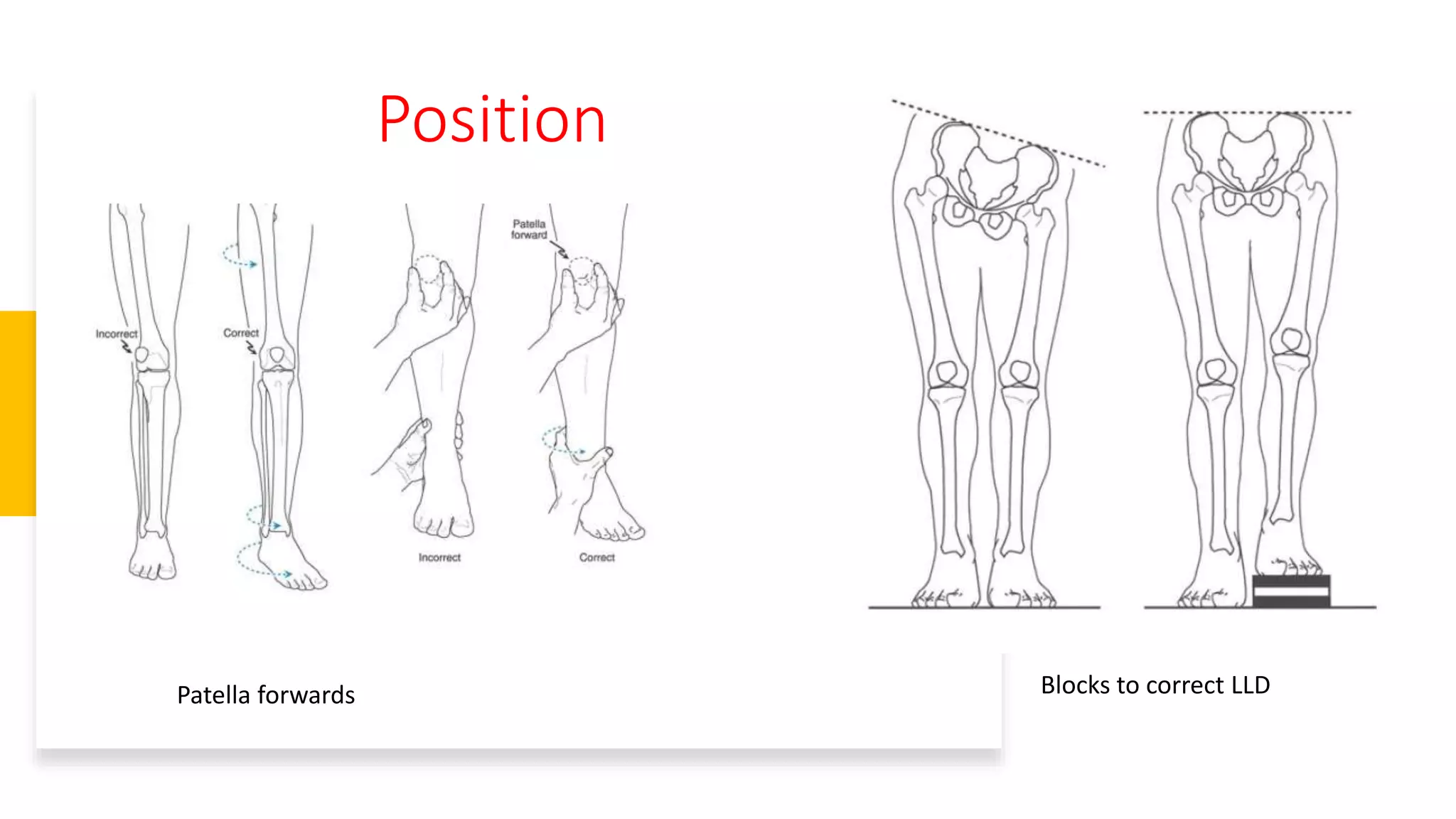Measurements Around Knee Ppt
