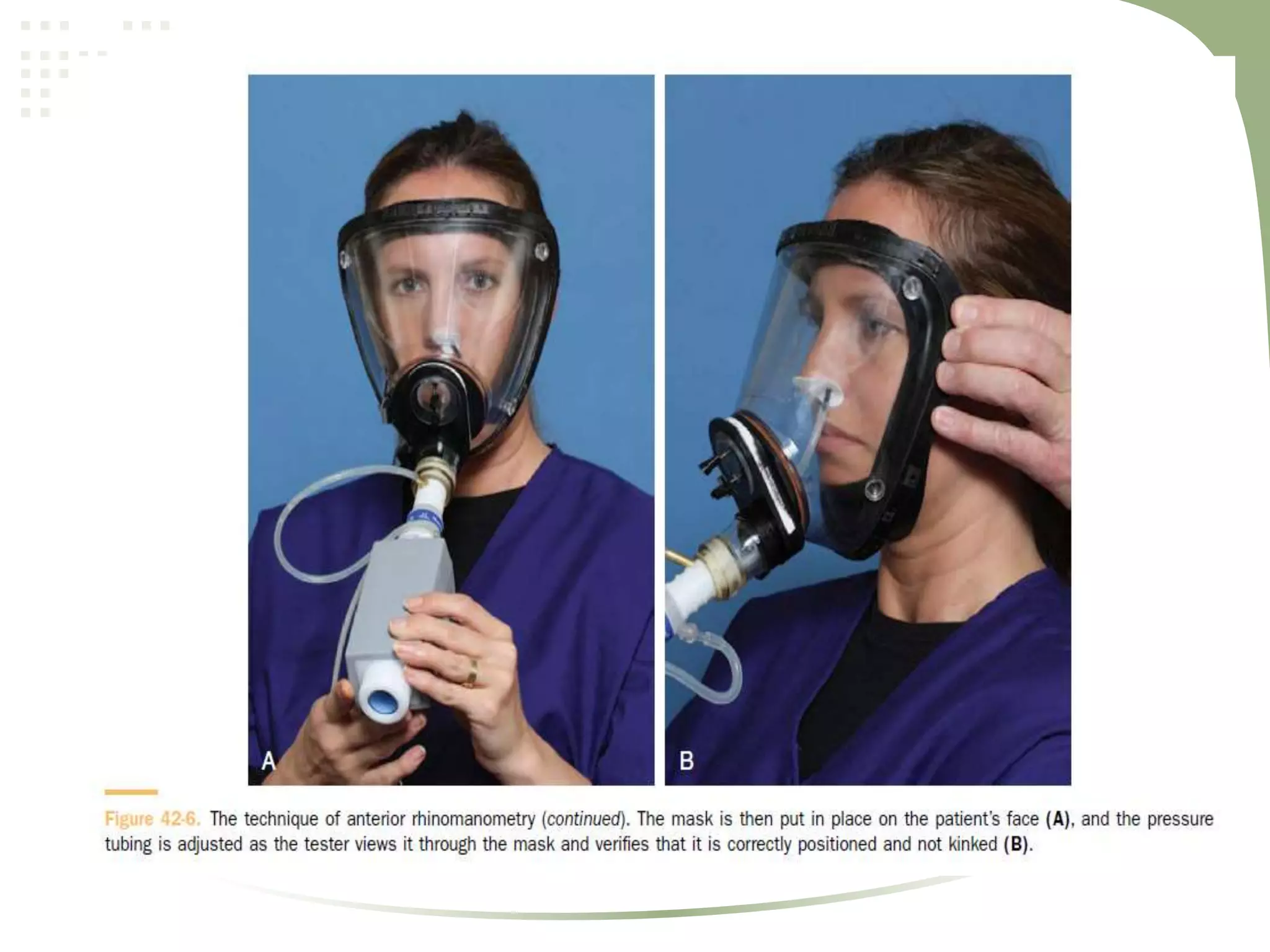 Measurements of nasal airway(dr ravindra daggupati),rhinomanometry ...
