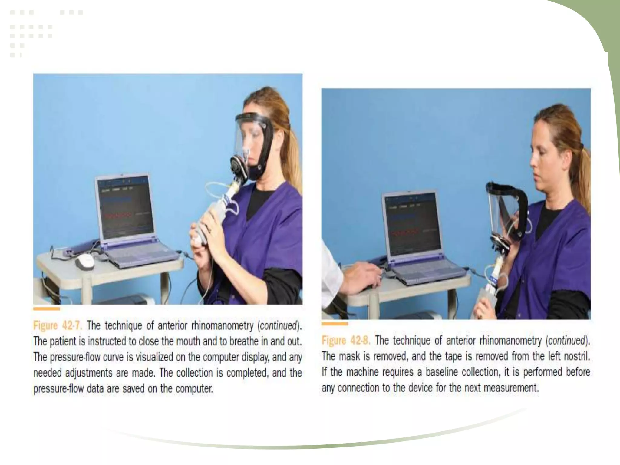Measurements of nasal airway(dr ravindra daggupati),rhinomanometry ...