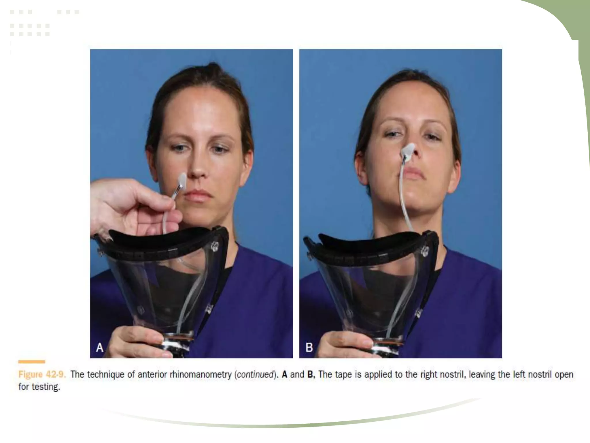 Measurements of nasal airway(dr ravindra daggupati),rhinomanometry ...