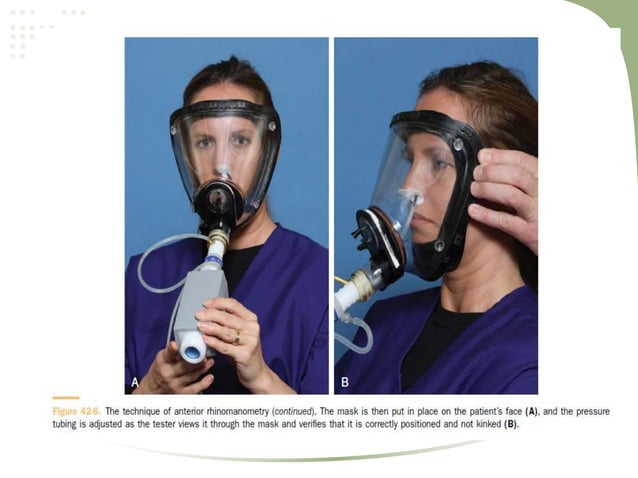Measurements of nasal airway(dr ravindra daggupati),rhinomanometry ...