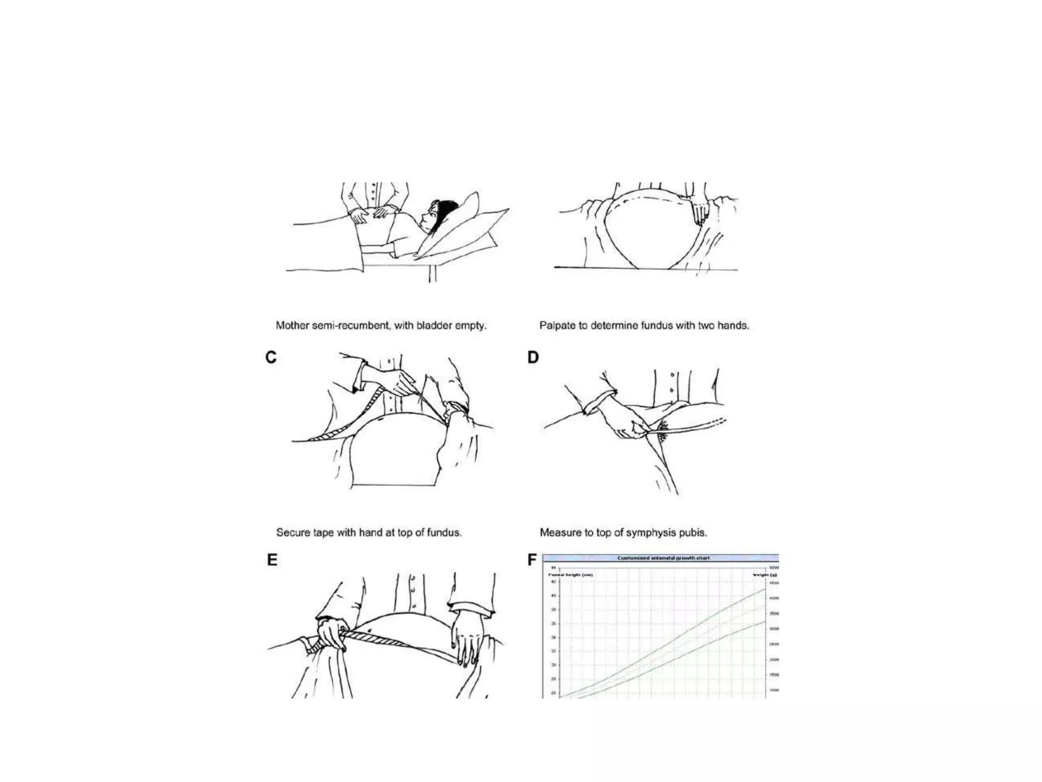 measuring of fundal height.pptx