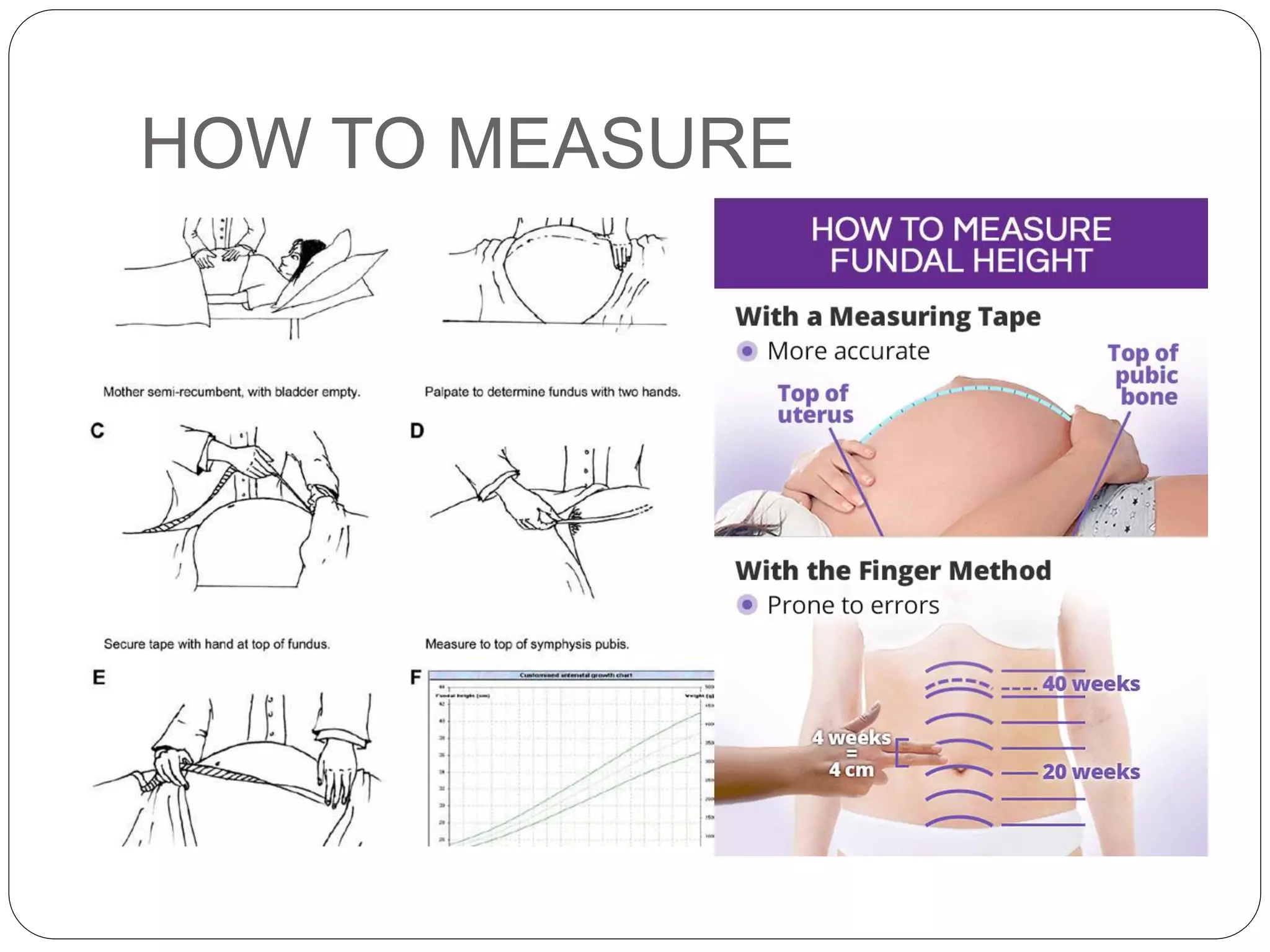 Measuring Of Fundal Height pptx Measuring Of Fundal Height pptx