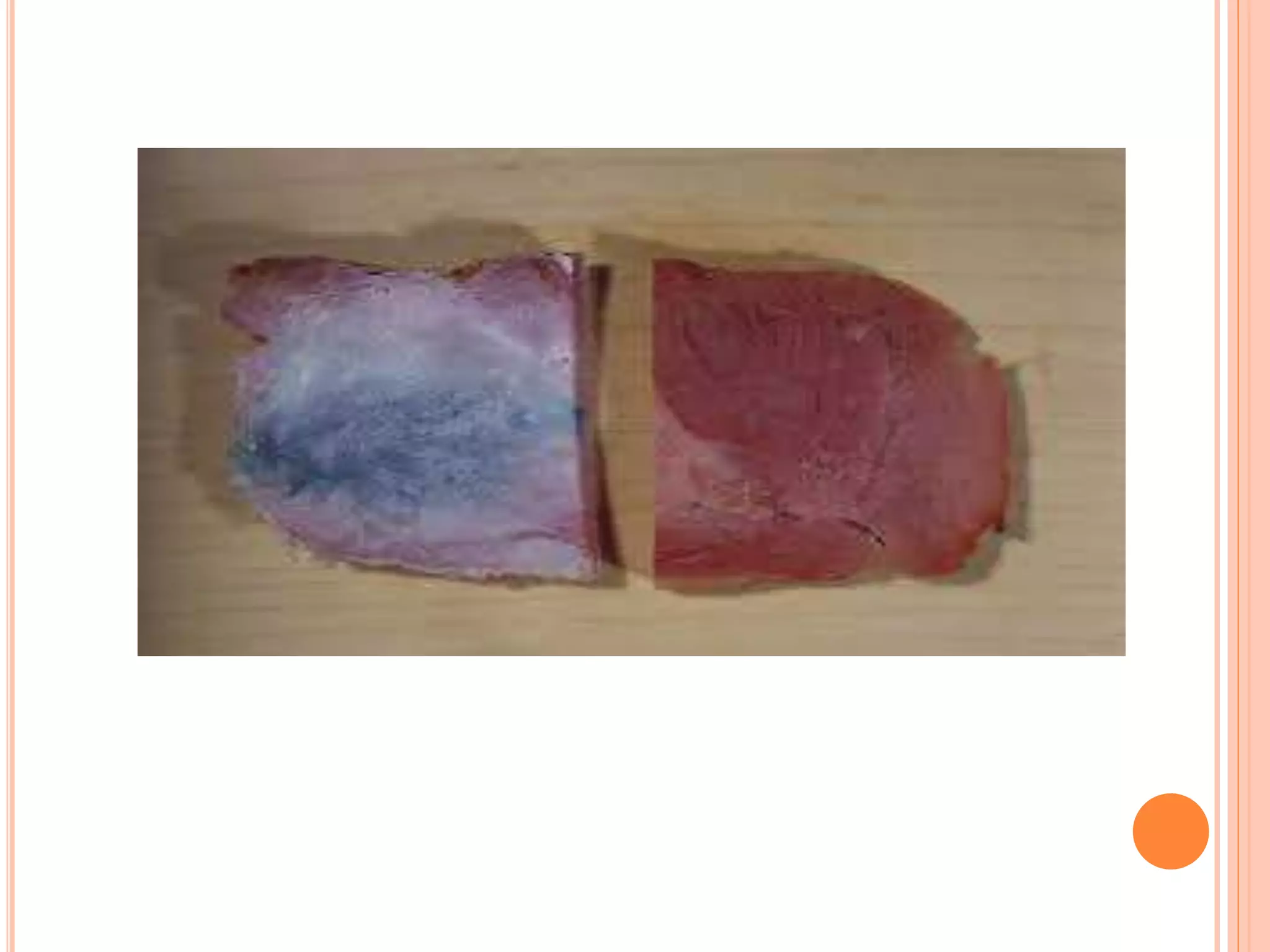 Microbial spoilage of meat & meat products | PPTX