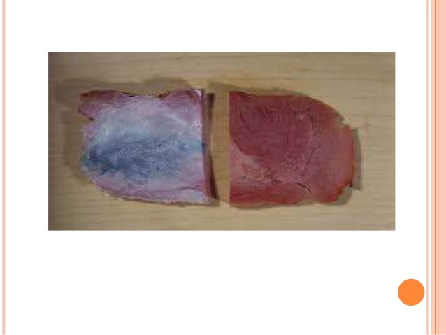 Microbial spoilage of meat & meat products