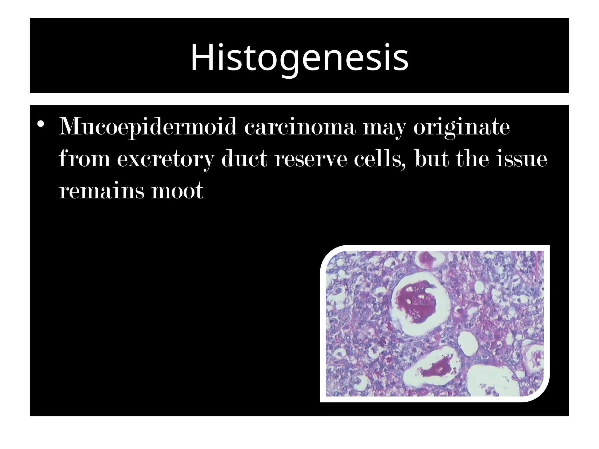 Mucoepidermoid carcinomas salivary gland | PPTX