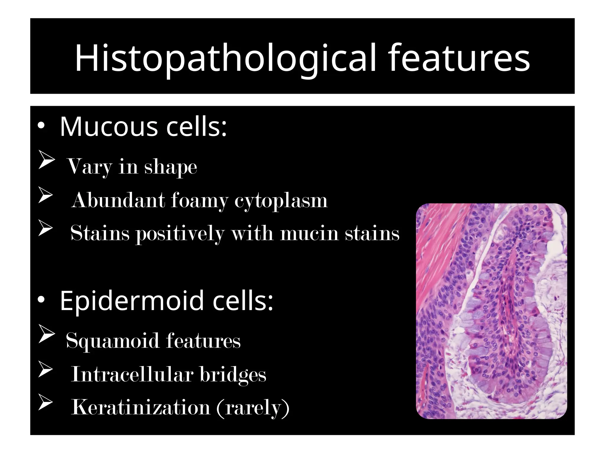 Mucoepidermoid carcinomas salivary gland | PPTX
