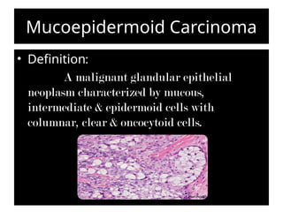 Mucoepidermoid carcinomas salivary gland | PPTX