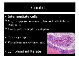 Mucoepidermoid carcinomas salivary gland | PPTX