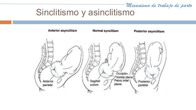 Mecanismo del trabajo de parto