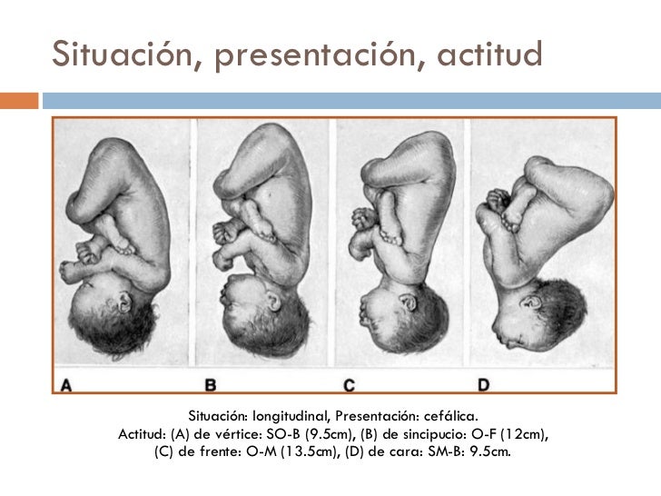 Mecanismo del trabajo de parto