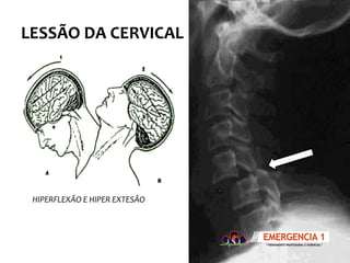 Mecanismo de Lesão e Cinemática do Trauma.pdf