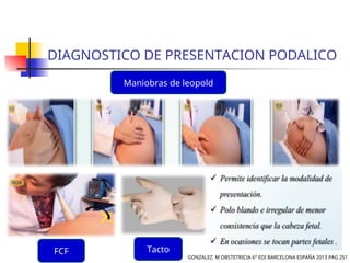 MECANISMO DEL PARTO PODALICO Y VARIEDADES JOSELYN ABAD.ppt