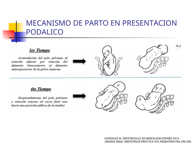 MECANISMO DEL PARTO PODALICO Y VARIEDADES JOSELYN ABAD.ppt