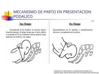 MECANISMO DEL PARTO PODALICO Y VARIEDADES JOSELYN ABAD.ppt