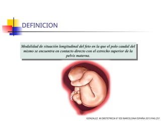 MECANISMO DEL PARTO PODALICO Y VARIEDADES JOSELYN ABAD.ppt