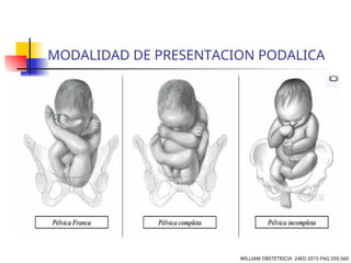 MECANISMO DEL PARTO PODALICO Y VARIEDADES JOSELYN ABAD.ppt