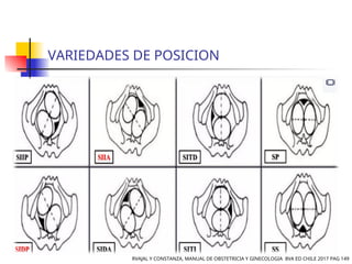 MECANISMO DEL PARTO PODALICO Y VARIEDADES JOSELYN ABAD.ppt