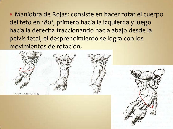 Mecanismo de parto