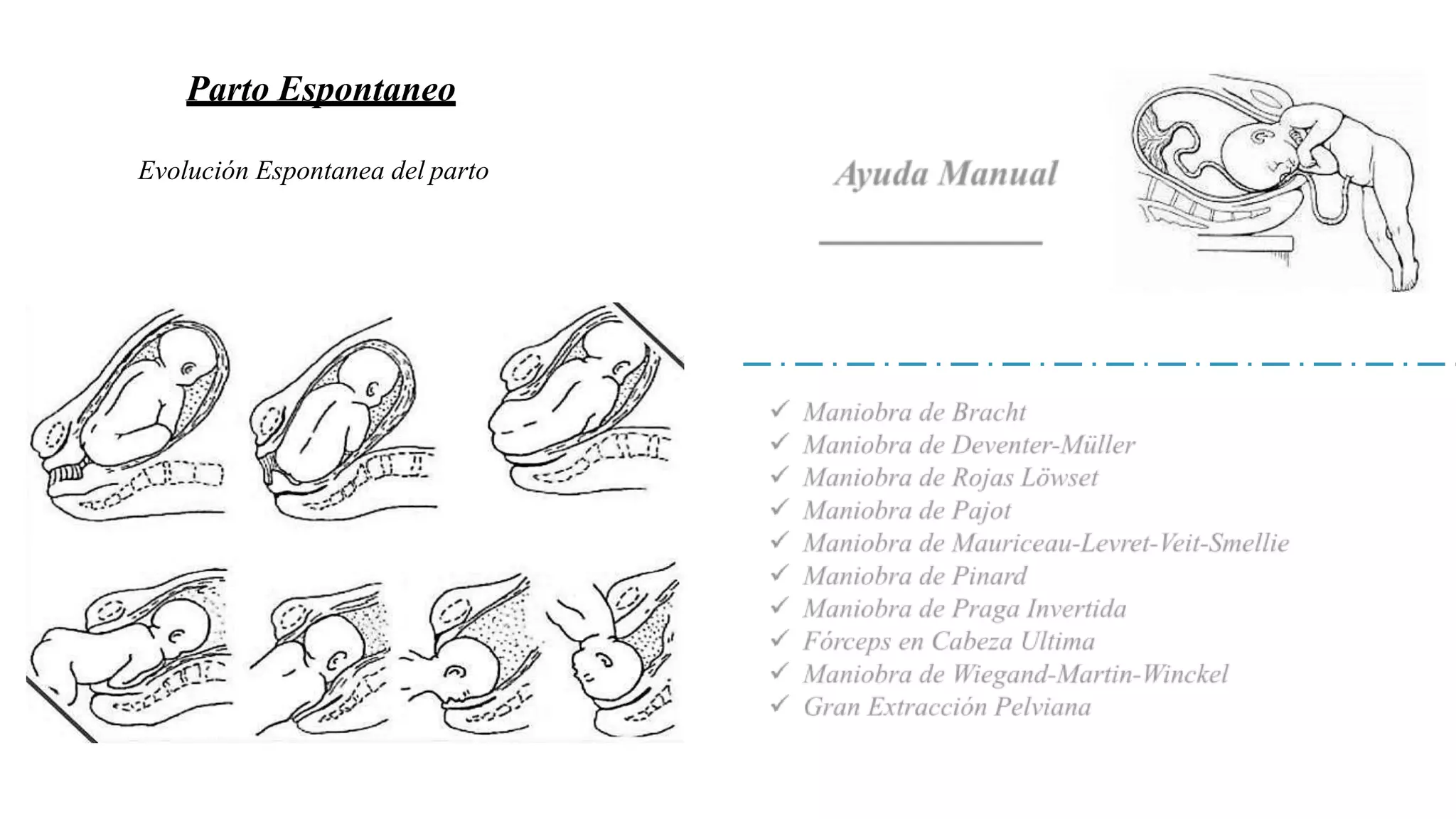 Mecanismo de parto.pptx