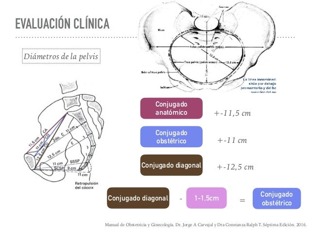 Mecanismo de Parto en Vértice