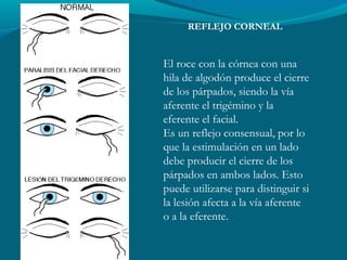 Mecanismo de reflejo | PPT