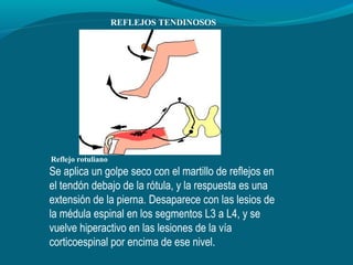 Mecanismo de reflejo | PPT