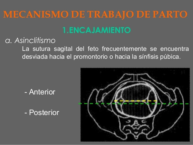 Mecanismo de trabajo de parto