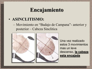 Mecanismo de Trabajo de Parto Cefálico.ppt