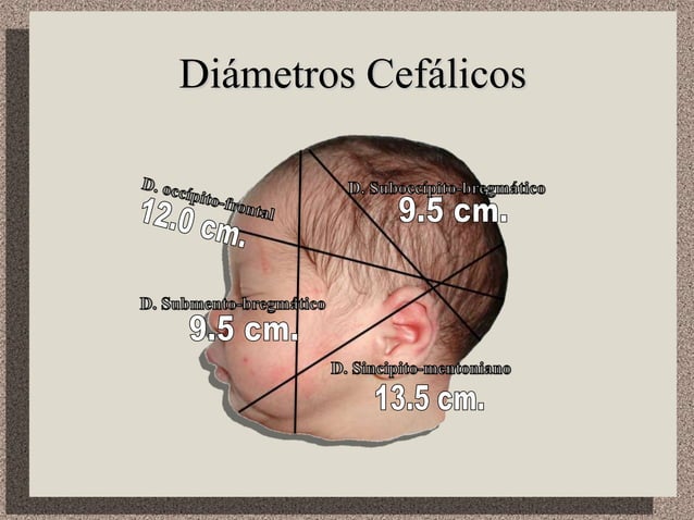 Mecanismo de Trabajo de Parto Cefálico.ppt