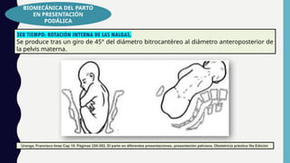 MECANISMO DE TRABAJO DE PARTO EN PRESENTACIÓN PODÁLICA.pptx