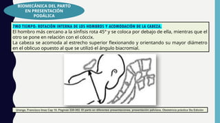 MECANISMO DE TRABAJO DE PARTO EN PRESENTACIÓN PODÁLICA.pptx