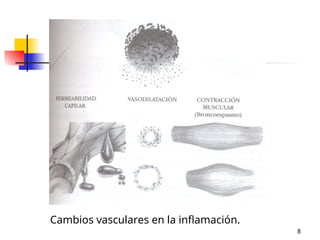 SISTEMA INMUNOLOGICO Y SU MECANISMOS DE LA INFLAMACIÓN.ppt
