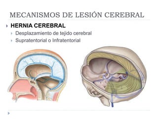 Mecanismos de lesión cerebral | PPTX