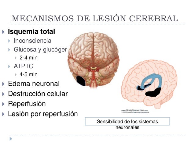 Mecanismos De Lesión Cerebral